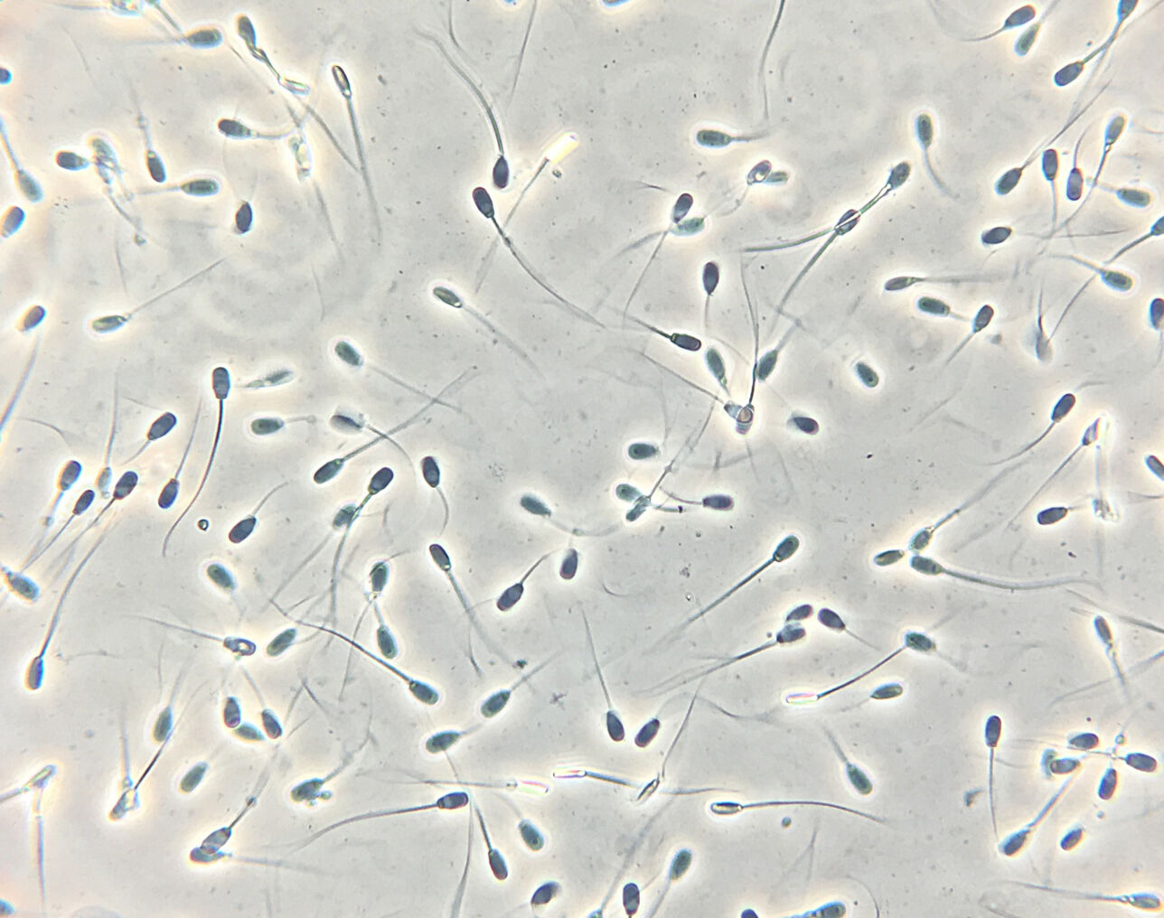 Topigs Norsvin | Swine Reproduction Platform
